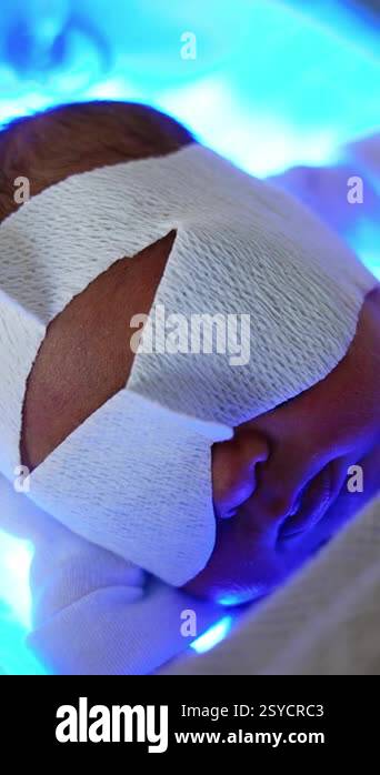 Lovely infant having the phototherapy. Little newborn lies on a lamp in ...