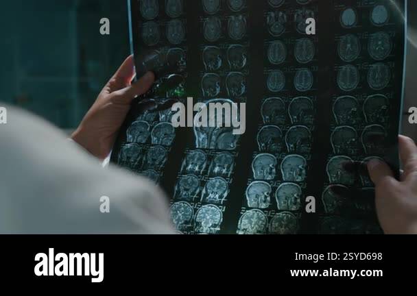 Coronal planes Stock Videos & Footage - HD and 4K Video Clips - Alamy