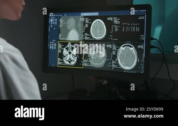 Over-shoulder shot of female radiology diagnostician in white coat ...