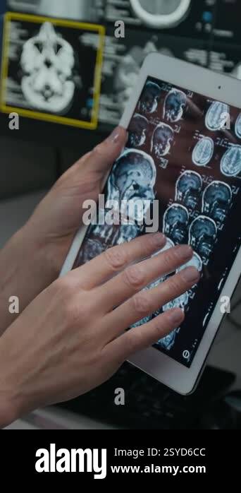 Vertical closeup of hands of anonymous female radiologist scrutinizing ...