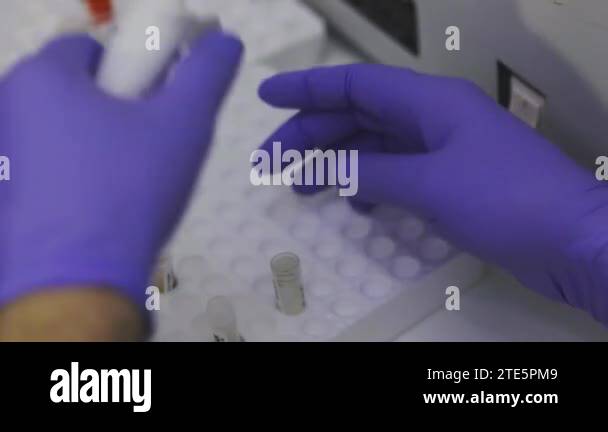 Researcher in a medical laboratory. Hands of a medical worker close up ...