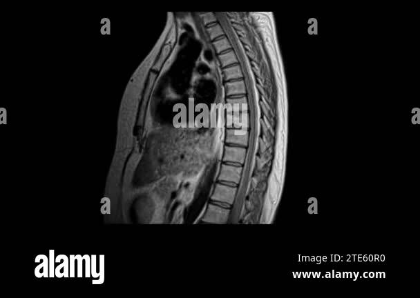 Thorax side view, x-ray of the thoracic spine, MRI of internal organs ...