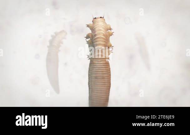 Demodex in hair follicles Stock Videos & Footage - HD and 4K Video ...