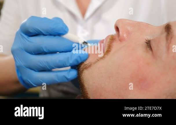 Cosmetologist marks face before beauty injection procedure. Doctor ...