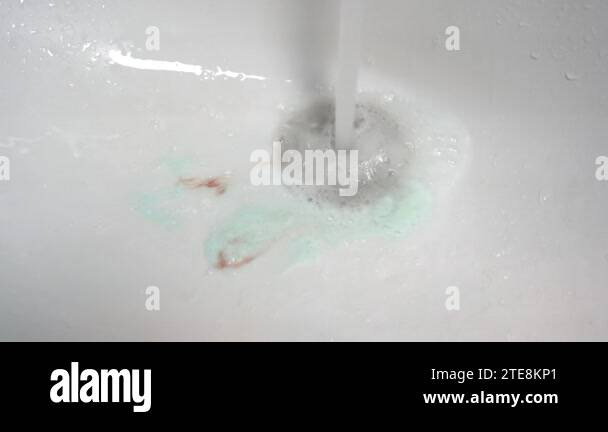 Toothpaste With Blood in the Sink. Blood When Brushing Teeth Stock ...