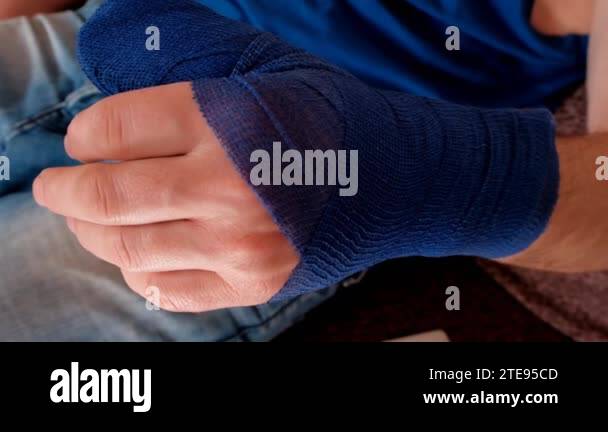 Blue surgical bandage on the arm. Medicine concept. Fractures and ...