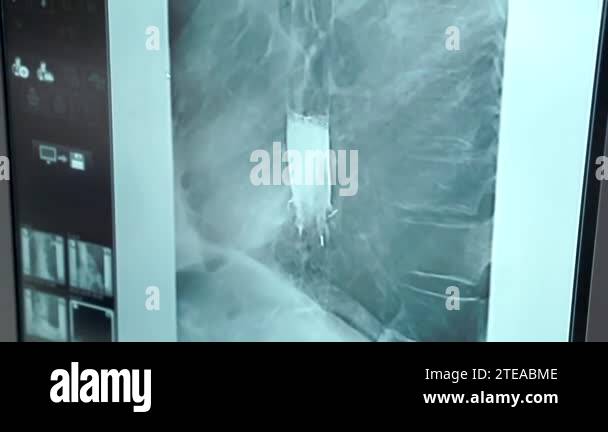 Imaging processes Stock Videos & Footage - HD and 4K Video Clips - Alamy