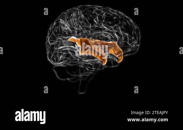 Brain Anterior part of superior temporal gyrus Anatomy For Medical ...