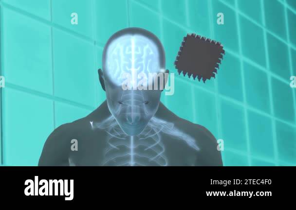 Implant chip Stock Videos & Footage - HD and 4K Video Clips - Alamy