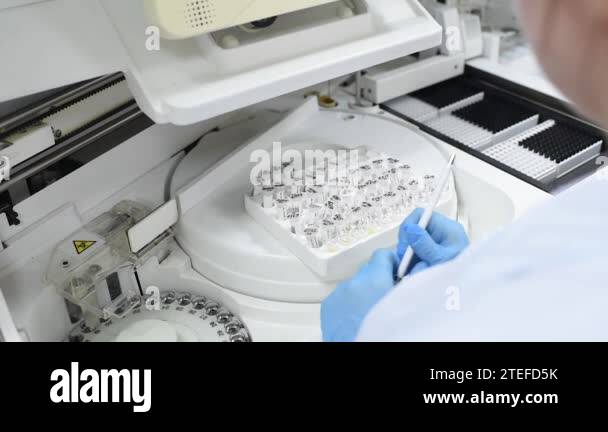modern automated machine in the working process, clinical chemistry ...