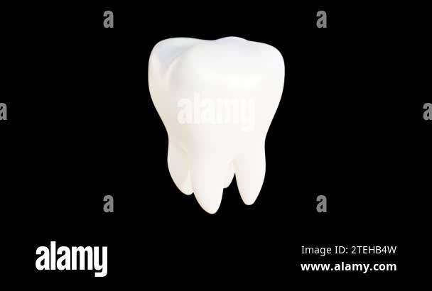 3d animation of tooth enamel destruction in stages caries, cracks ...