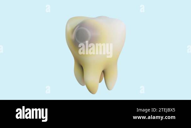 Enamel filling Stock Videos & Footage - HD and 4K Video Clips - Alamy