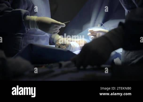 surgical center in procedure fistula for dialysis focus selective and ...