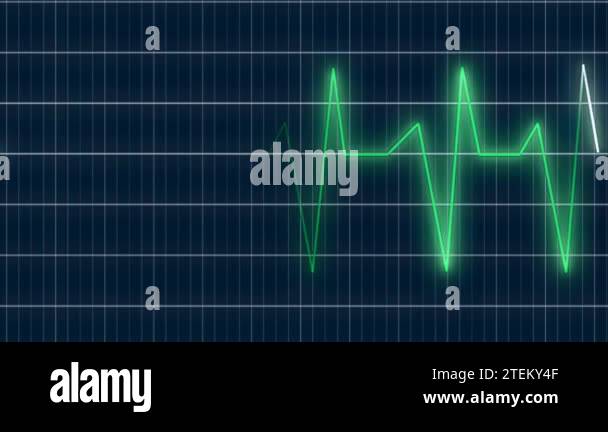 Heart rate graph Stock Videos & Footage - HD and 4K Video Clips - Alamy