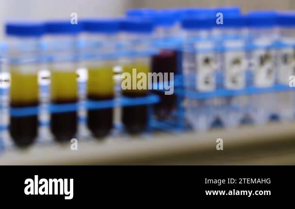 Bokeh Blur to Focused Stage One Seperated Blood in Conical Centrifuge Tubes Under a Sterile Hood ...