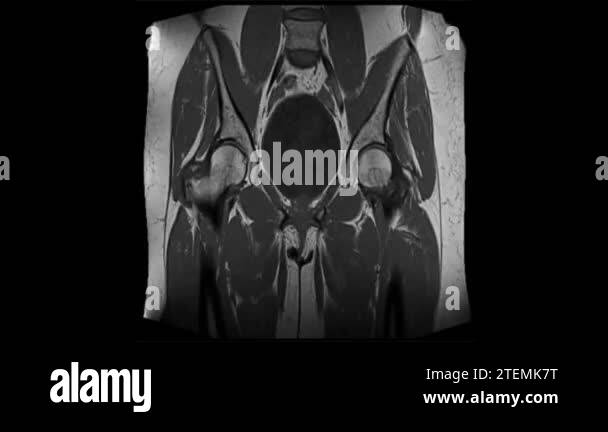 Female reproductive system. The human reproductive system. X-ray of the ...