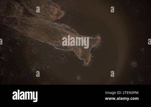 A microscopic view of rotifers in phase contrast lighting. The pumping ...