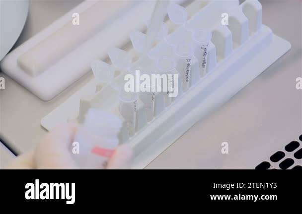 Sample preparation - extraction of DNA from blood samples in a laminar ...