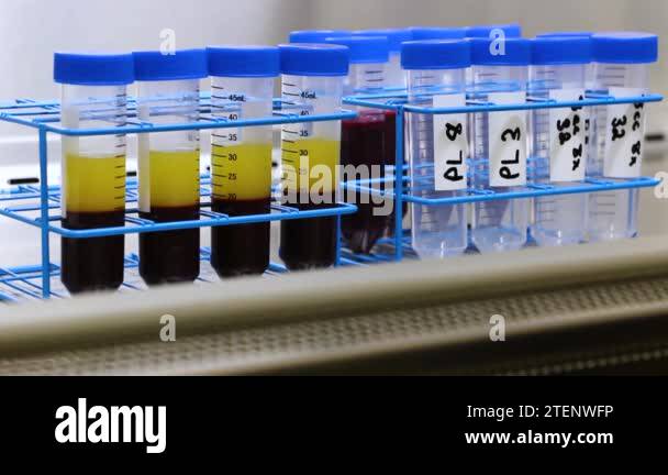 Close Up Establishing Shot of Seperated Blood in Conical Centrifuge ...