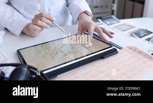 Cardiologist explaining patient ekg Stock Videos & Footage - HD and 4K ...