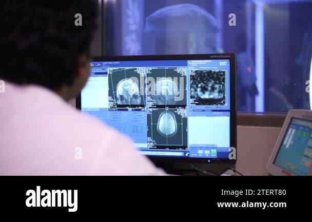 MRI research. Brain imaging. Pictures of the brain scan on the monitor ...