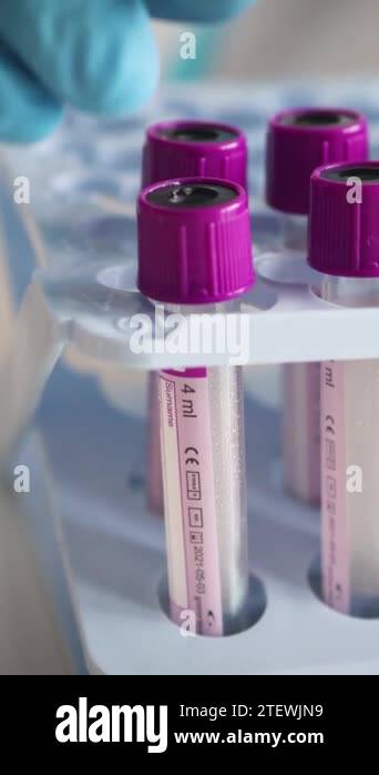 Process of coronavirus PCR antigen testing examination by nurse medic ...