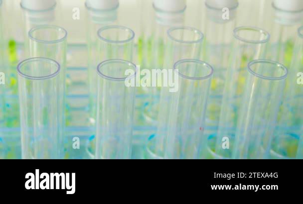 Researcher drips a sample of infected blood into a test tube - close-up ...