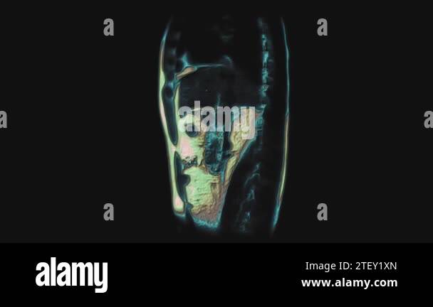 Bulk multicolored CT scan of the abdomen. Computed tomography of the ...