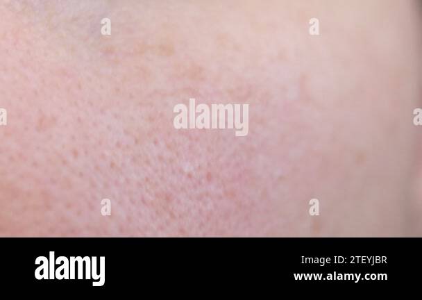 pores on the face. oily skin of the face. Part of a womans face close ...
