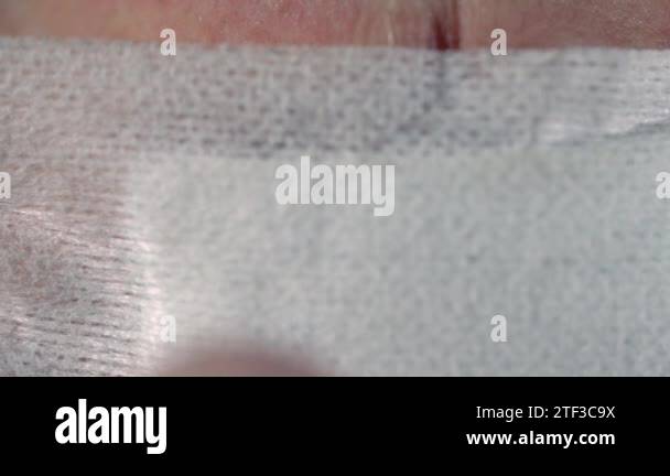 Sterile gauze dressing Stock Videos & Footage - HD and 4K Video Clips ...