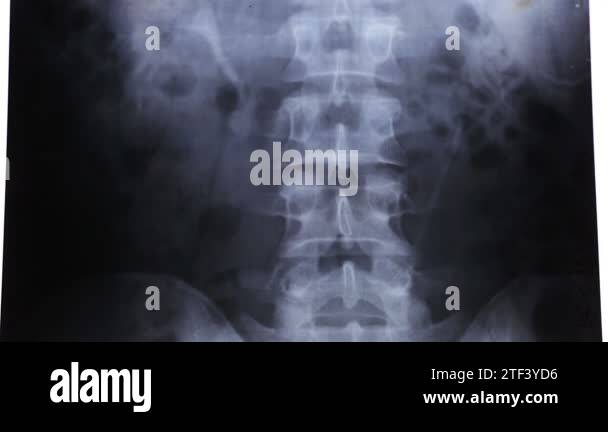 X-rays are a type of electromagnetic radiation, just like visible light ...