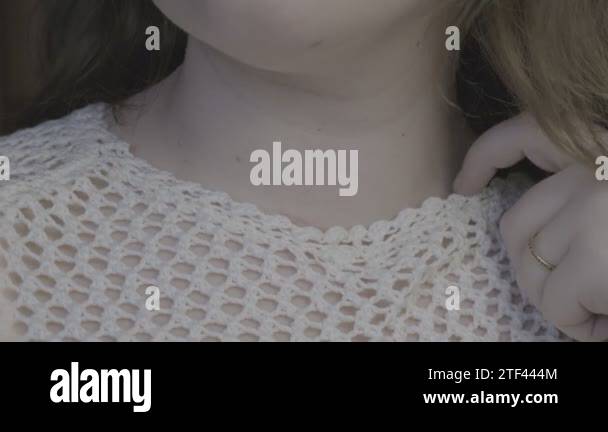 Scar on the neck. surgical wounds, removal of tumor and thyroid cancer ...