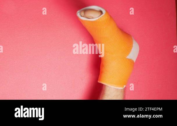 Foot with broken toe bone in orange fiberglass cast pink background ...