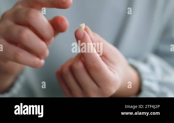 Little Girl Loosing her baby teeth. Little girl with milk temporary ...