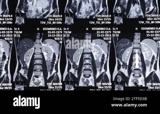 X-rays are a type of electromagnetic radiation, just like visible light ...