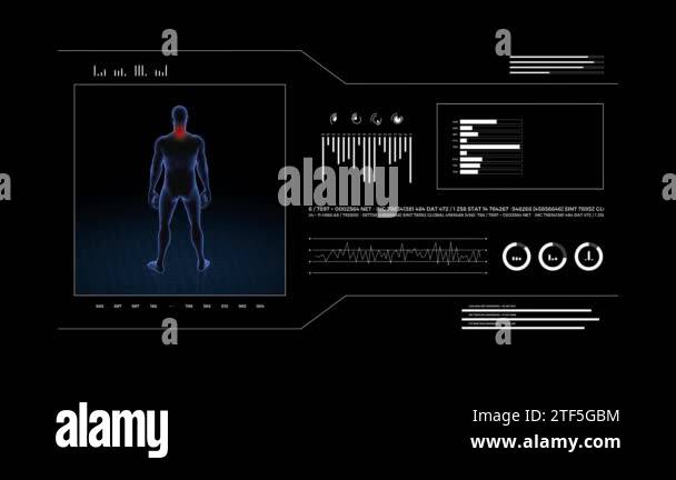 Man with cervical pathology. 3d body of boy. Rotating animation and ...