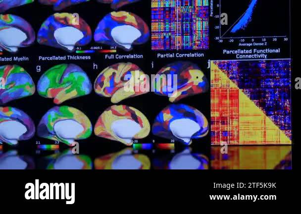 Scan image neuron synapse Stock Videos & Footage - HD and 4K Video ...