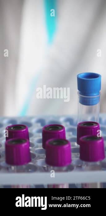 Process of coronavirus PCR antigen testing examination by nurse medic ...