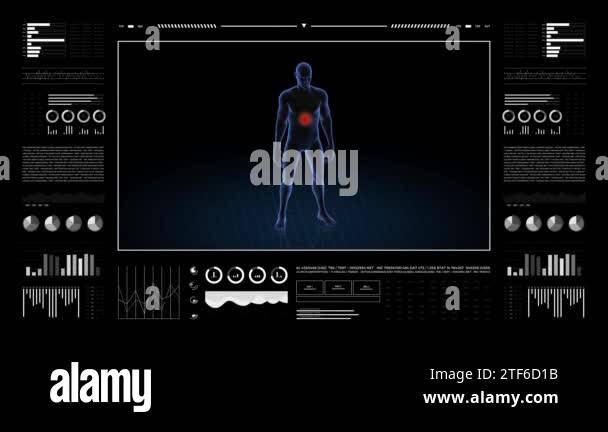 Man with pit of stomach pathology. 3d body of boy. Rotating animation ...