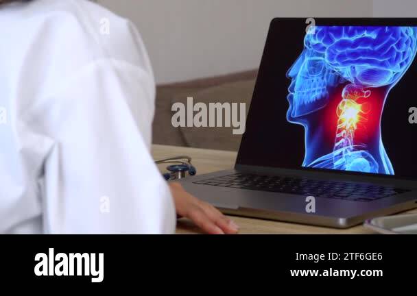 Close up of hand of a woman doctor showing a x-ray of pain in the neck ...