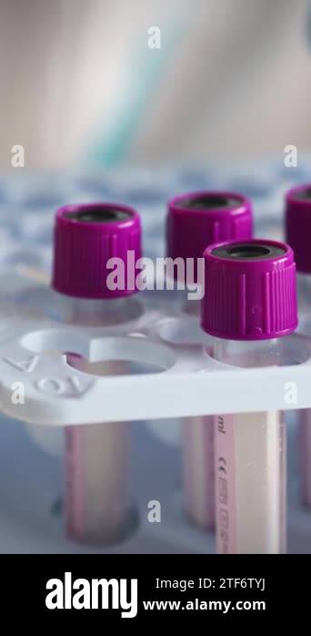 Process of coronavirus PCR antigen testing examination by nurse medic ...