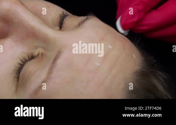 beauty injections of botulinum toxin preparations injections the doctor ...