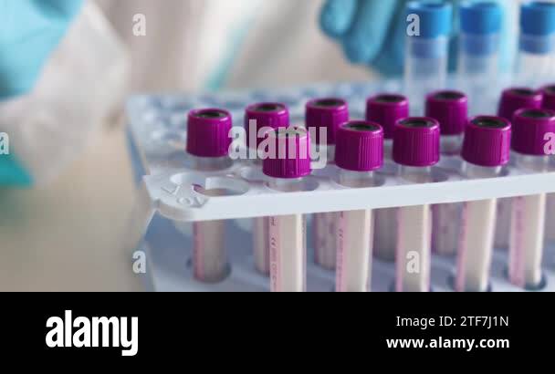 Process of coronavirus PCR antigen testing examination by nurse medic ...
