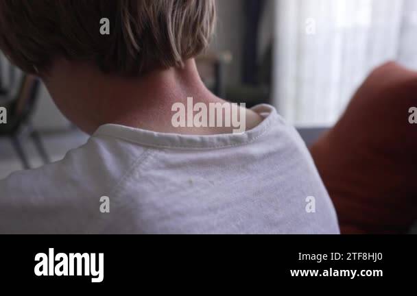 Symptoms of photodermatitis. Mom noticed a rash on the boys neck ...