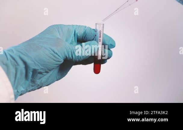 Extracting Blood Samples In A Tube Using Plastic Pipette Dropper For ...
