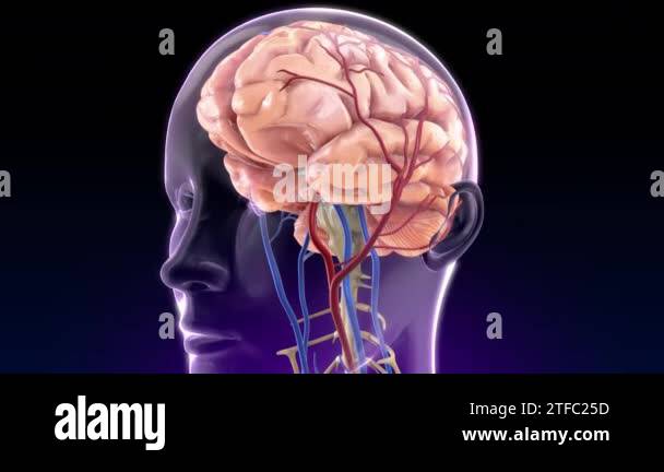 An animated simulation of a blood clot occurring in the brain, causing ...