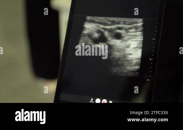 Diagnostic sonography ultrasonography ultrasound Stock Videos & Footage ...