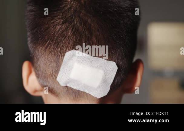 Fell head scar Stock Videos & Footage - HD and 4K Video Clips - Alamy