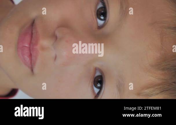 scratching his nose with a finger with the symptom of atopic dermatitis ...