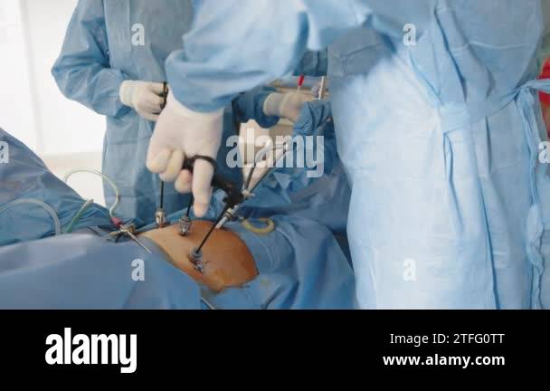 Operation using laparoscopic equipment. The surgeons doing laparoscopic ...